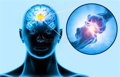 Human Brain Stimulation Or Activity With Neuron Stock Image Image Of Pulse Cell 278526025