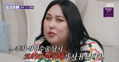 풍자 덩치 커 성형 수술 때 코끼리 마취 될 만큼 투여