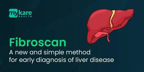Fibroscan A New And Simple Method For Early Diagnosis Of Liver Disease
