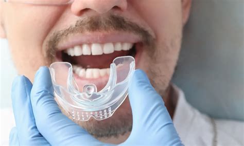Cuenin Orthodontics Orthodontists Located In Danville Ca