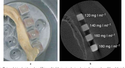 Figure 1 From Optimization Of Exposure Parameters For Cone Beam