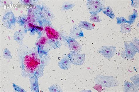 Showing Light micrograph Type of Tissue Human under the microscope 이미지 1757039086 게티이미지뱅크