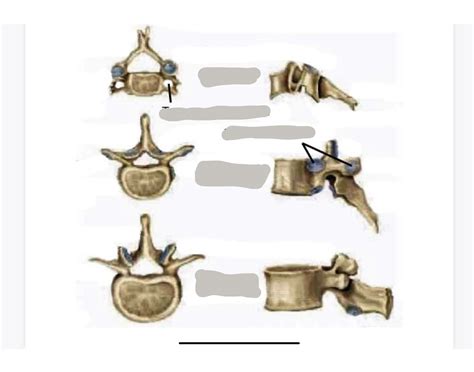 3 Main Categories Of Vertebrae Quiz