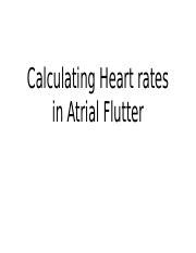 Understanding Atrial Flutter And Calculating Heart Rates Course Hero