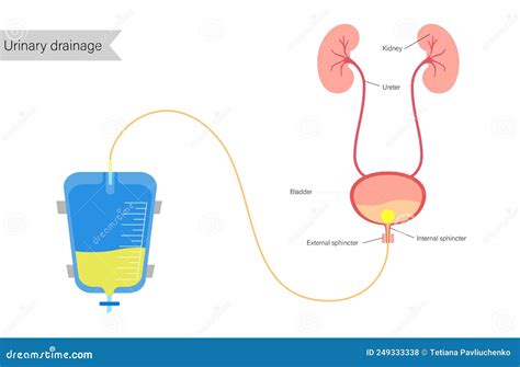 Catheter And Urine Bag Cartoon Vector 25054335