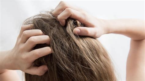 Here S How To Fix An Itchy Scalp Once And For All