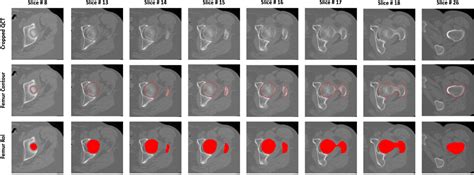 Figure 1 From A Deep Learning Based Method For Automatic Segmentation