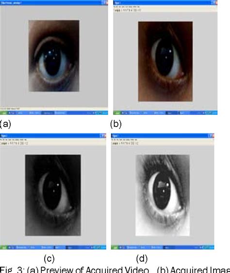Figure 2 From Design Of A Real Time System For Acquiring And Analyzing