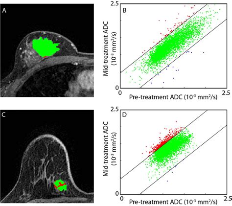 Evaluation Of PRMADC As A Response Metric Parametric Response Maps A Download Scientific