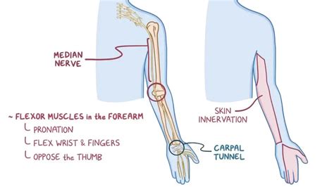 Median Nerve Palsy