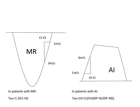 Left Ventricular Diastolic Time Constant Tau And Beyond