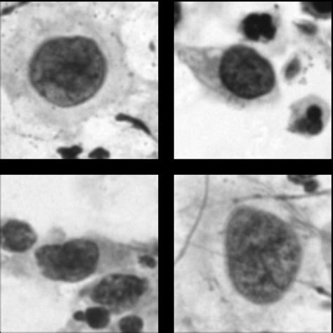 Example Images From The Herlev Dataset Download Scientific Diagram