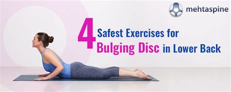 4 Safest Exercises For Bulging Disc In Lower Back