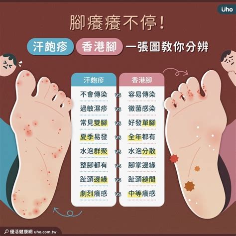 手腳長水泡會癢，是汗皰疹還香港腳？圖解6症狀差異，一文看原因及改善法 健康遠見
