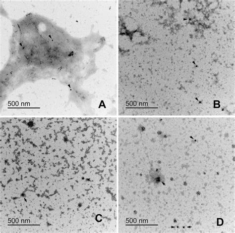 Electron Micrography Of The Immunolocalization Of Anti Amylin In Download Scientific Diagram