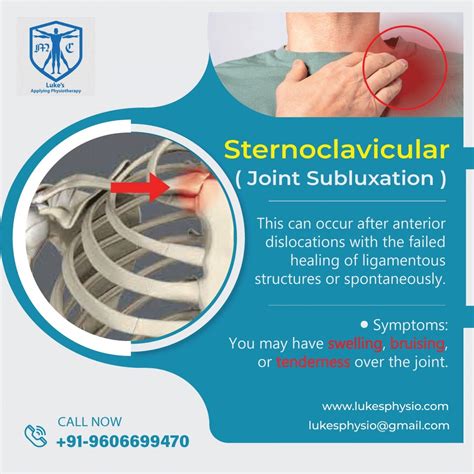 Sternoclavicular Joint Lukes Applying Physiotherapy