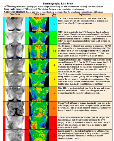 All About Thermograms Top Benefits For Monitoring Breast Health And Their Limitations