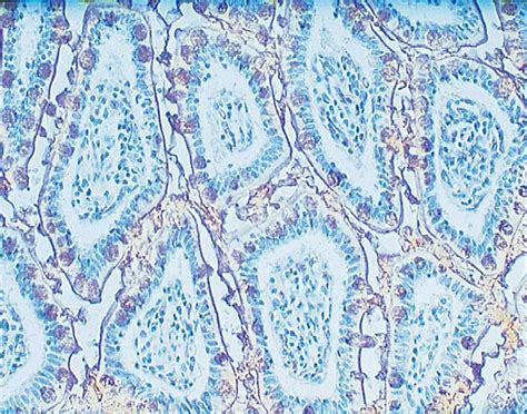 Leveraging Lectins For Glycan Analysis Vectorlabs