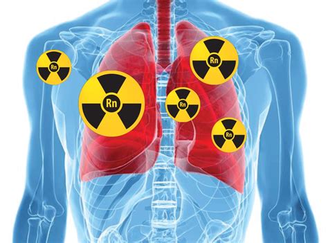 Exposure To Radon