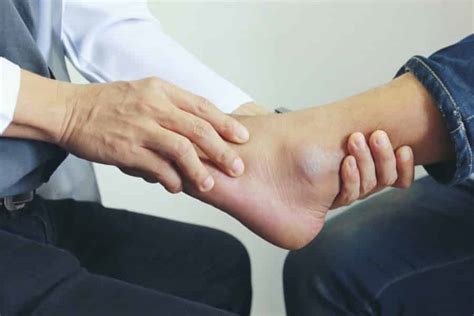 Broken Ankle Recovery Time Cellaxys