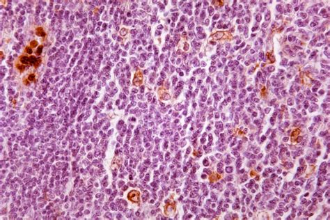 Human Tonsil Light Micrograph Stock Image C0606468 Science