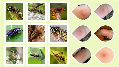 Different Types Of Insect Bites Identification With Picture