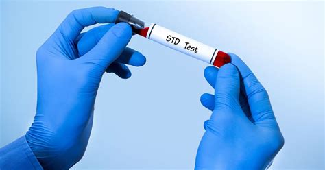 Where To Get Std Testing In Montreal Montreal Times Where To Get Std Testing In Montreal Montreal Times
