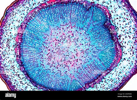 Common Pear Pyrus Communis Cross Section Of The Stem Microtome