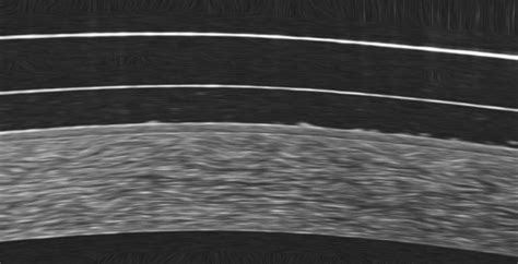 Example Of Application Of The Non Linear Anisotropic Diffusion Filter Download Scientific