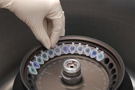 Scientist Loading A Sample To Centrifuge Stock Photo At Vecteezy