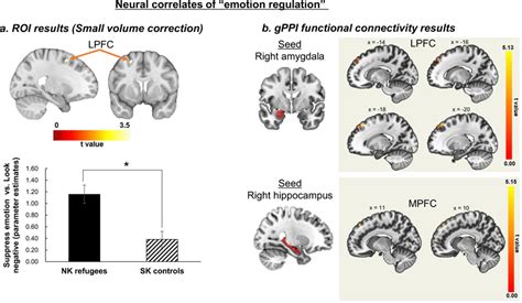 Neural Correlates Of Emotion Regulation A Left Lateral Prefrontal Download Scientific Diagram