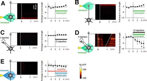 A Combination Of A Somatic Calcium Rise And Membrane Depolarization