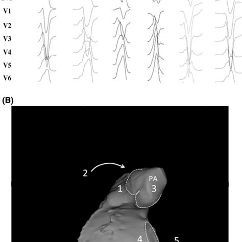 Monomorphic A Pleomorphic B And Polymorphic C Vt Reproduced Download Scientific