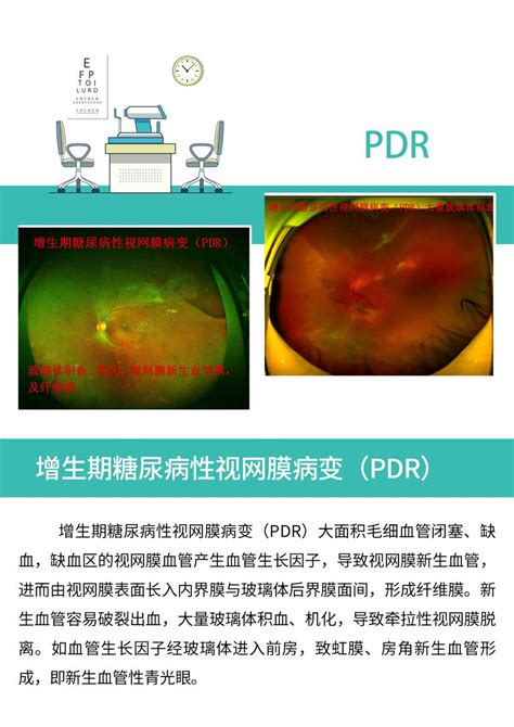 糖尿病视网膜病变 京东健康