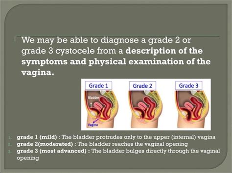 Cystocele Physical Examination Ppt