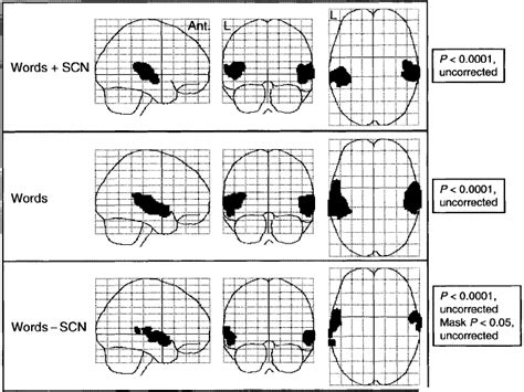 Experiment 1 Statistical Parametric Maps Displayed As Sagittal