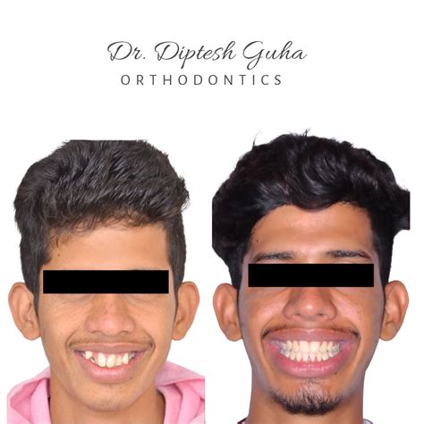 Dr Diptesh Guha Posted On Linkedin