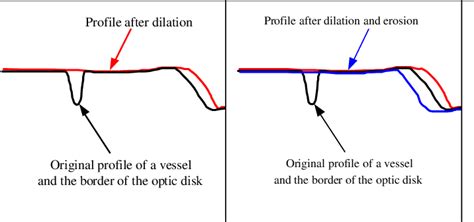 Representation Of The Three Stages Of Morphological Filtering Which Are