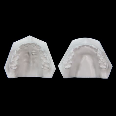 Or 18bw Pedo White Crossbite Paradigm Dental Models