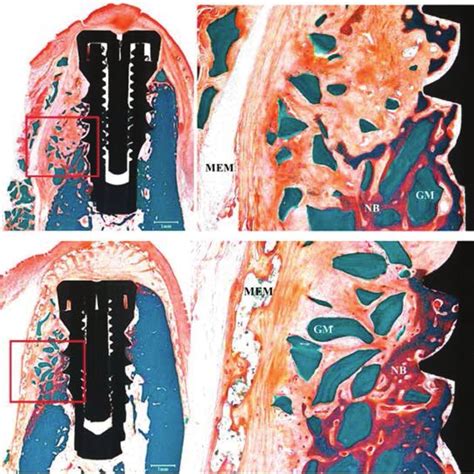 Histological Analysis Of Implant Osseointegration Red Box Selection Download Scientific