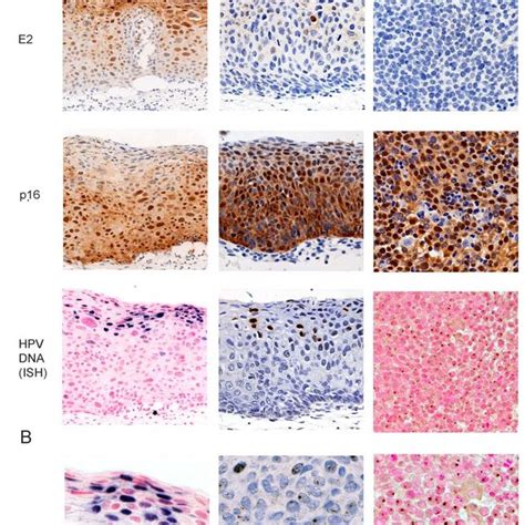 Schematic Representation Of The Hpv16 Early Transcripts According To