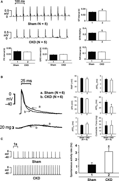 A ECGs Showed Prolongation Of QT Interval And QTc But Not RR Download Scientific Diagram