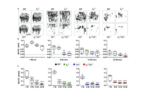 Absence Of L5 Accelerates Age Associated Trabecular Bone Loss A