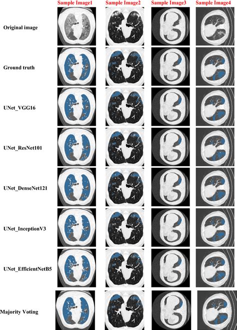 Segmentation Results Of Random Samples On Dataset Download Scientific Diagram