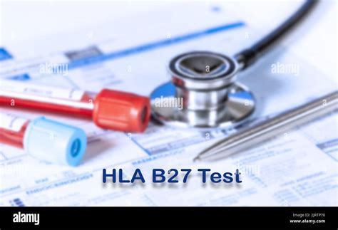 Hla B27 Test Testing Medical Concept Checkup List Medical Tests With