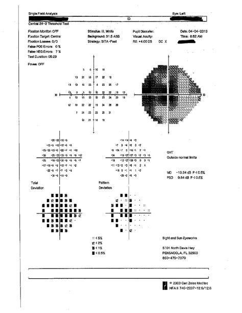 Assessing Visual Fields — Vision Rehab Ot