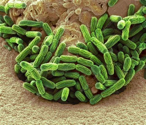 Bacteria From Stagnant Water Sem Stock Image C057 3003 Science Photo Library