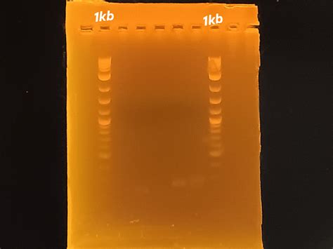 Gel Electrophoresis Diagram
