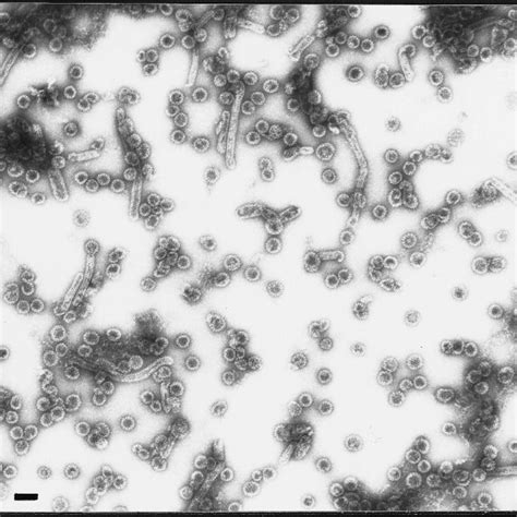 Transmission Electron Microscopy Of Purified Hpv 16 Like Particles Used Download Scientific