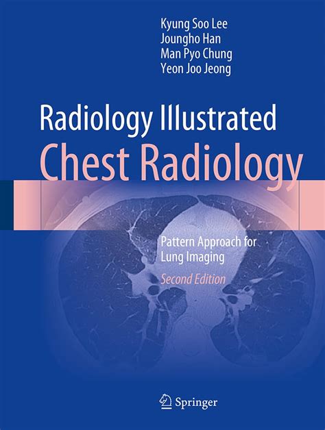Buy Radiology Illustrated Chest Radiology Pattern Approach For Lung